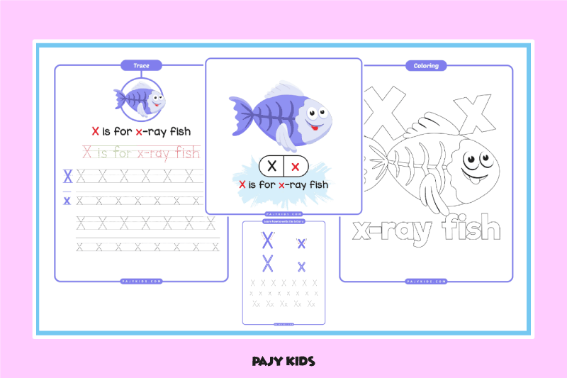 X is for x ray: Preschool Letter X Activities